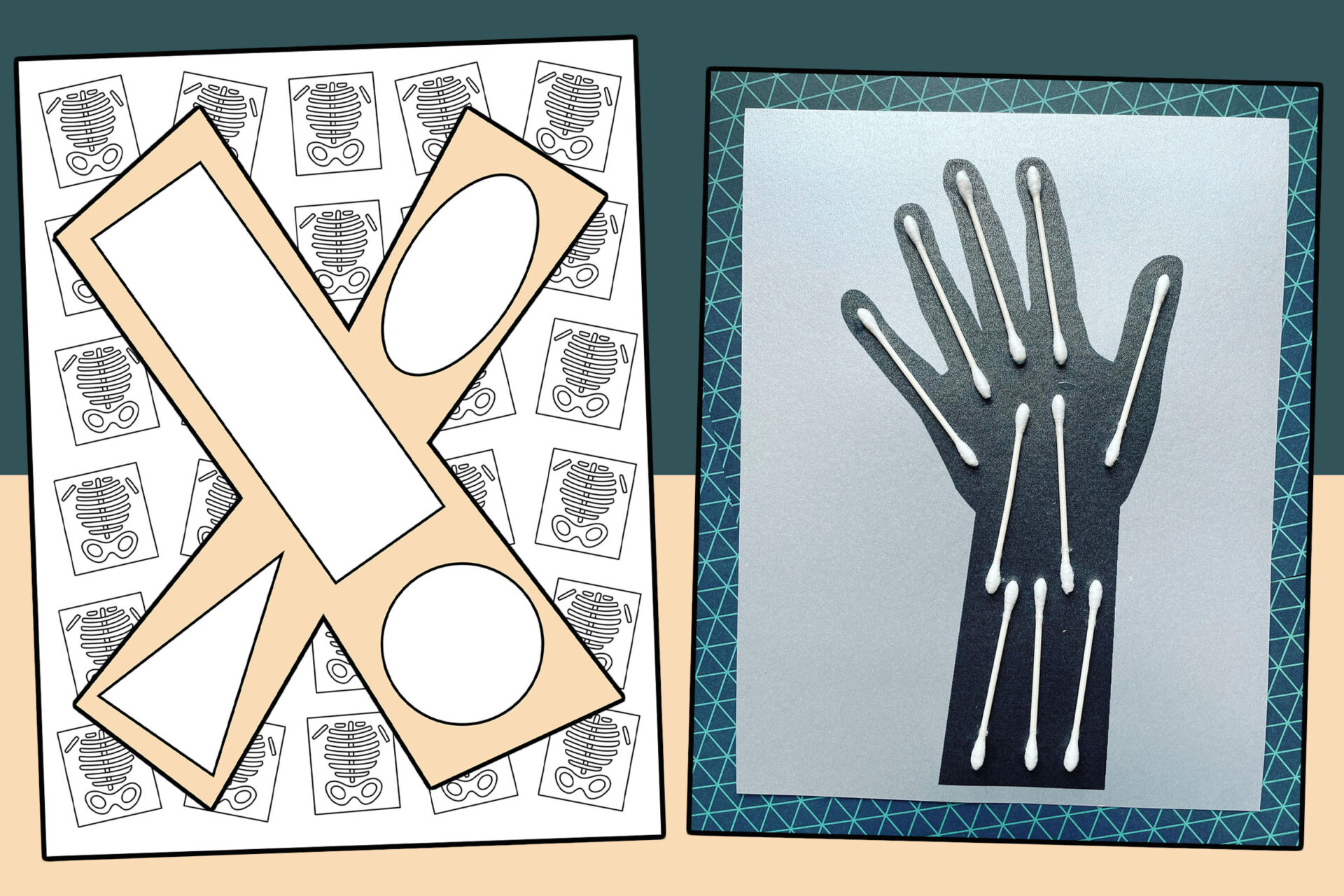 Letter X Activities Preschool